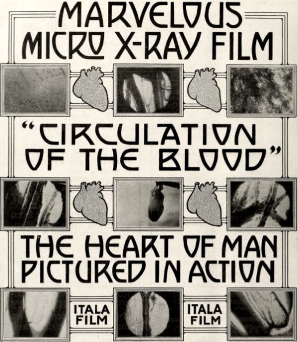Circulation of the Blood (movie, 1913)