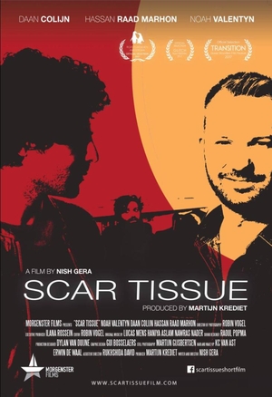 Scar Tissue (movie, 2017)